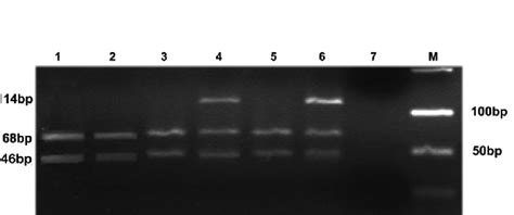 Ethidium Bromide Stained 3 Agarose Gel Picture Showing Flt3 Tkd
