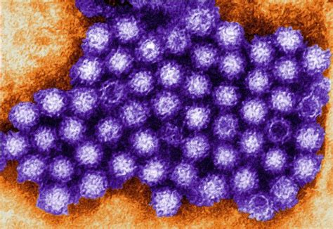 Norovirus Infection Free Images Public Domain Images