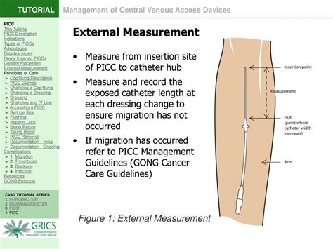 Ppt 4 Peripherally Inserted Central Catheter Picc Powerpoint Presentation Id735059