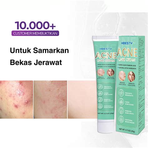 Jual Cream Penghilang Bekas Jerawat Bopeng Dan Flek Penghilang