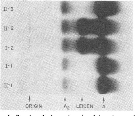 Figure 1 From Imbalance In Alpha And Beta Globin Synthesis Associated