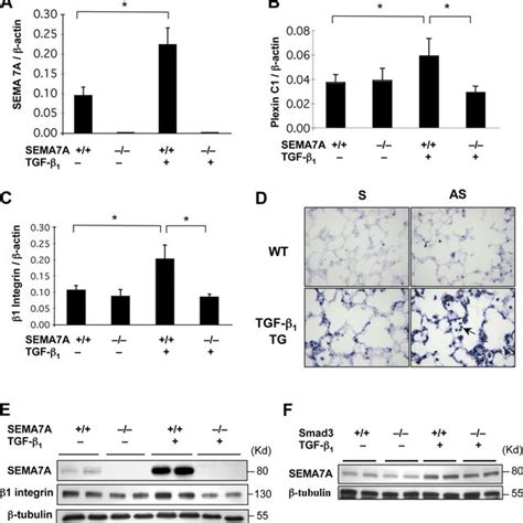 Roles Of Sema 7a In Tgf β1induced Fibrosis And Alveolar Remodeling