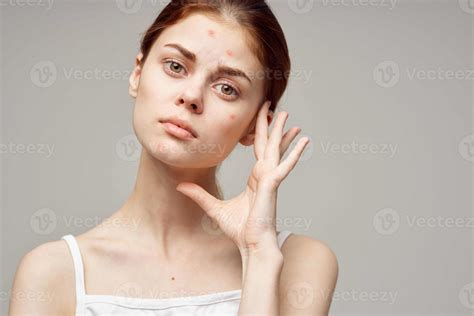 Red Haired Woman Cosmetology Skin Care Puberty Isolated Background Stock Photo At Vecteezy