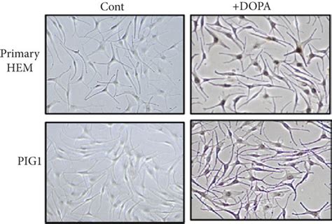 Characterization Of Melanocytes And H2o2 Induced Oxidative Death A
