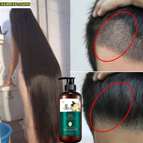 Ginger Pangpahaba Ng Buhok Shampooblack Beauty Shampoo Shampoo Ng