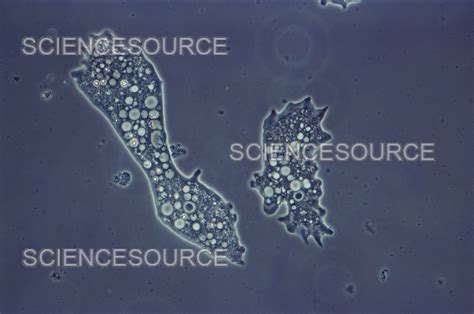 Amoeba Proteus Lm Stock Image Science Source Images