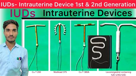 Copper Iud No Side Effects At Kristie Rhodes Blog
