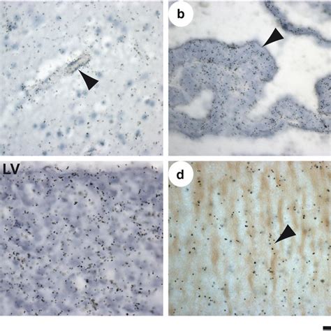 Mct8 Immunostaining In The Fetal Cerebral Cortex Representative