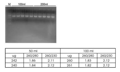 Plasmid Midiprep Kit