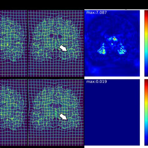 Comparisons On OASIS Validation Set Our Method Produces More Regular