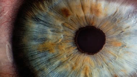 Etdrs Visual Acuity Test For Managing Diabetic Retinopathy Good Lite Co