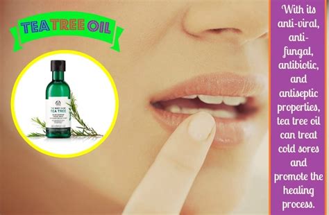 27 Best Home Remedies For Cold Sores On Lips And In Mouth