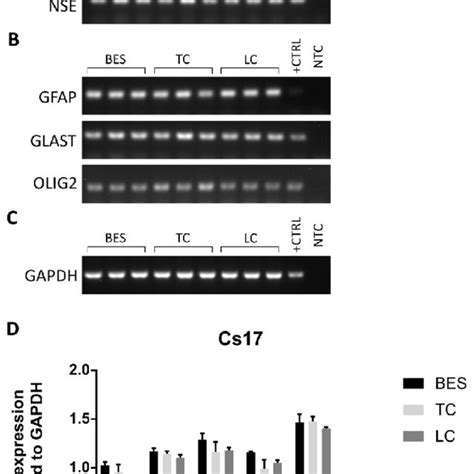 Expression Of Neural Markers In Hnscs Neuronally Differentiated For 4