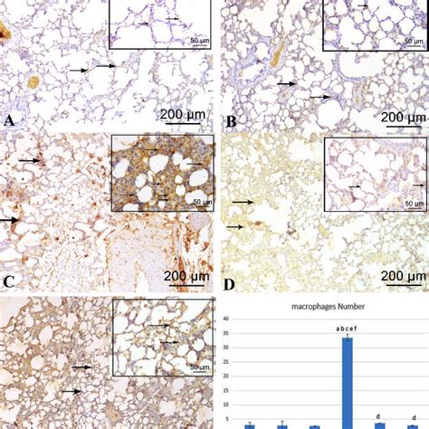 Masson Trichrome Stained Lung Tissue Sections At100× Magnifications