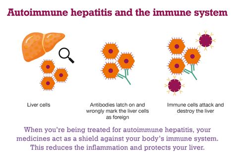 What Causes Autoimmune Hepatitis British Liver Trust