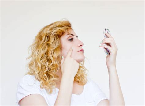 Acne Around Mouth Healthy Blog