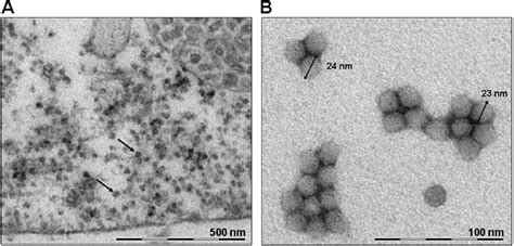 Electron Microscopic Analysis Of Human Bocavirus Hbov Viral Protein 2