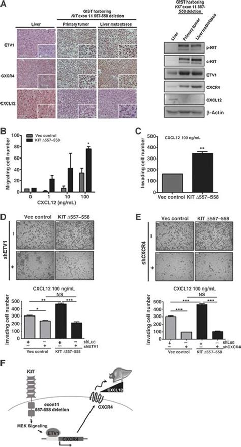 Kit Exon 11 Codons 557558 Deletion Mutation Promotes Liver Metastasis