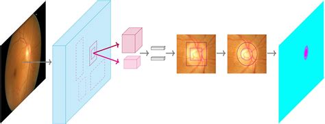 Optic Disc And Cup Localization From Retinal Fundus Images Via Deep Object Detection Networks
