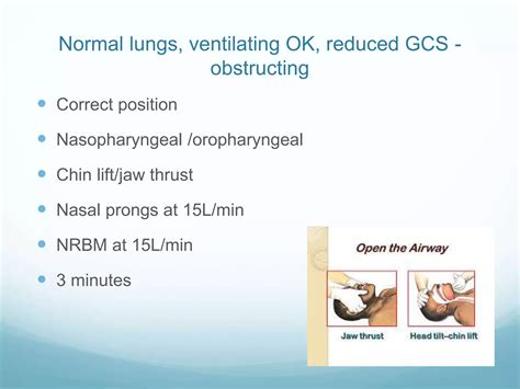 Delayed Sequence Intubation Ppt