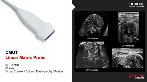 Linear Matrix Cmut Probe For Clear Images Throughout All Trimesters