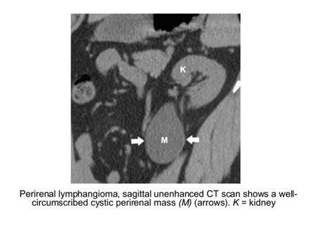 Diagnostic Imaging Of Perinephric Space
