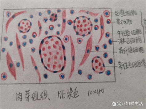 病理学实验报告（损伤，修复）