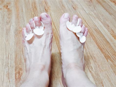 무좀 발가락사이 가려움 해결 발갈라짐 진정효과 쾌발클로버링 네이버 블로그