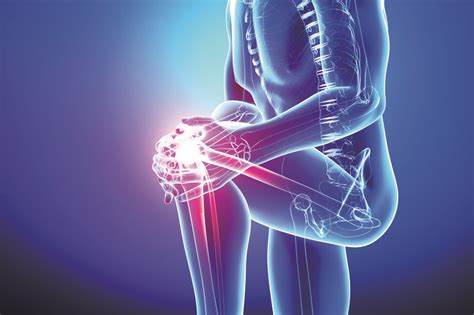 Orthopedics Images