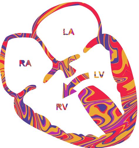 Ventricular Septal Defect Intercontinental Care