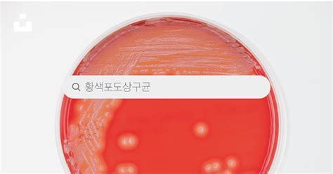 황색포도상구균 사진 Unsplash에서 무료 이미지 다운로드