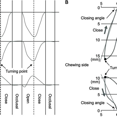 The Mean Paths Of The Average Chewing Pattern During Unilateral Gum