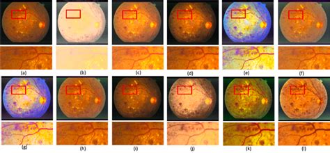 Subjective Evaluation Of Section Of Input And Improved Photos Of