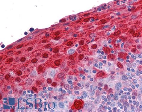 Ihc Plus™ S100a7 Psoriasin Polyclonal Antibody Goat Lsbio