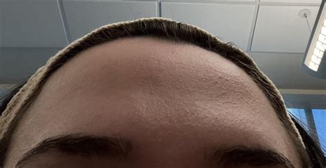 How To Get Rid Of This Texture Rskincareaddicts