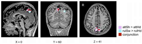Common Sources Of Control For Shifting Spatial Attention And Switching Download Scientific
