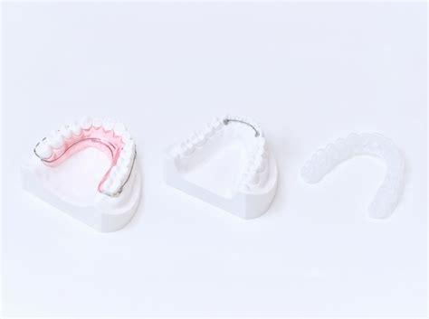 保定・メンテナンスについて｜矯正治療終了後に後戻りしないために