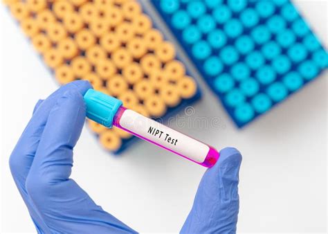 NIPT Or Non Invasive Prenatal Testing Diagnosis For Fetal Down