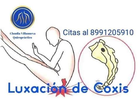 El Bloqueo Del Coxis Quiropraxia Claudia Villanueva