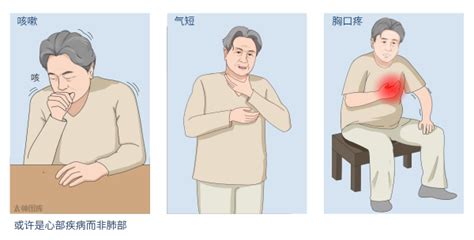 心脏疾病 医学插画