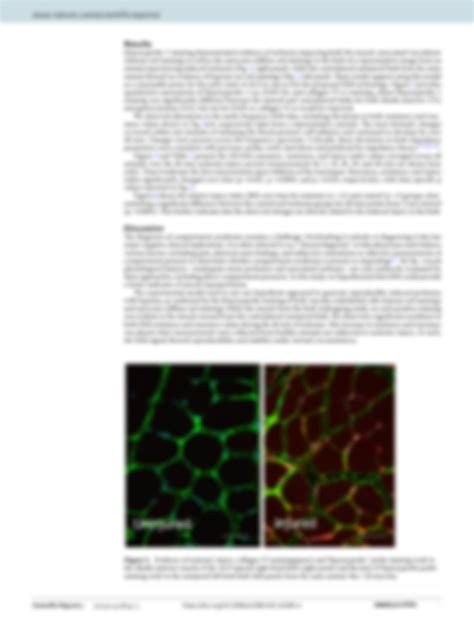 Solution Electrical Impedance Myography For The Early Detection Of Muscle Ischemia Secondary To