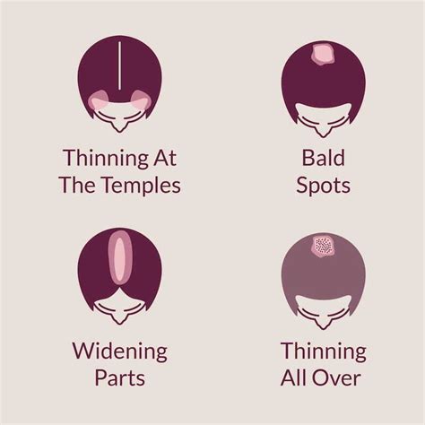 You Dont Have To Suffer Another Day Of Hair Thinning