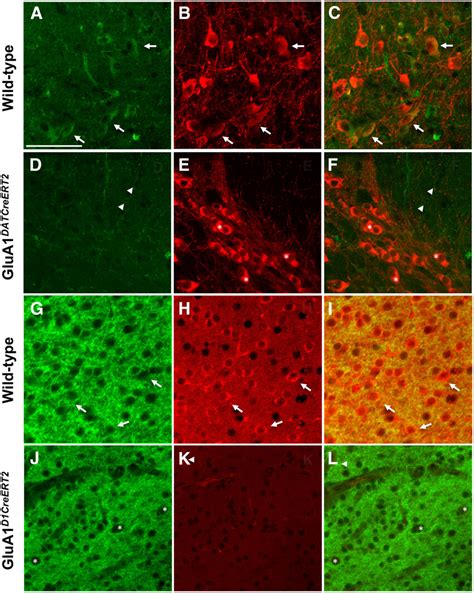 Lack Of Glua1 In Daergic And D1 Expressing Cells In Mutant Mice