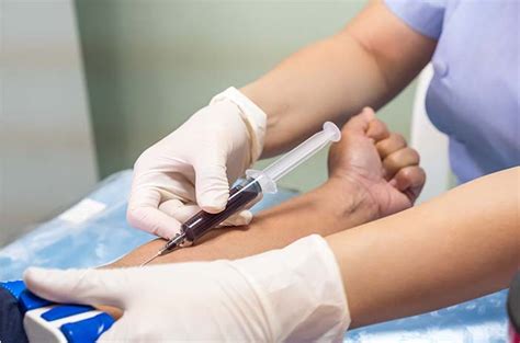 Ketahui Pentingnya Tes HIV Meskipun Sudah Menikah
