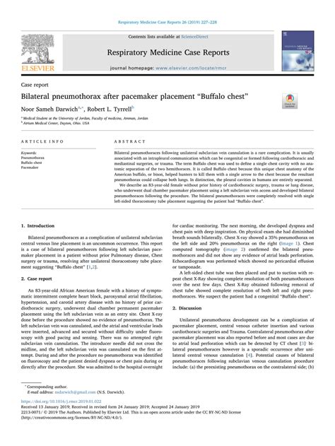 Pdf Bilateral Pneumothorax After Pacemaker Placement “buffalo Chest”