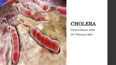 Cholera Presentation Pptx