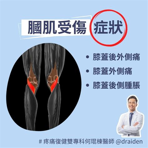 膕肌受傷症狀 何琨棟醫師 Dr Aiden