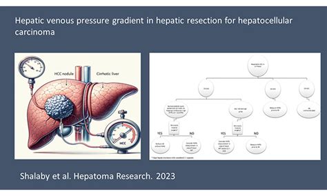 Hepatoma Research Oae Publishing Inc