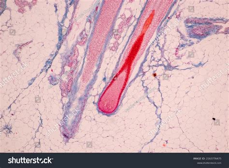Scalp Hair Follicles Human Under Microscope Stock Photo Shutterstock