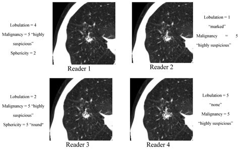 Algorithms Special Issue Machine Learning For Medical Imaging